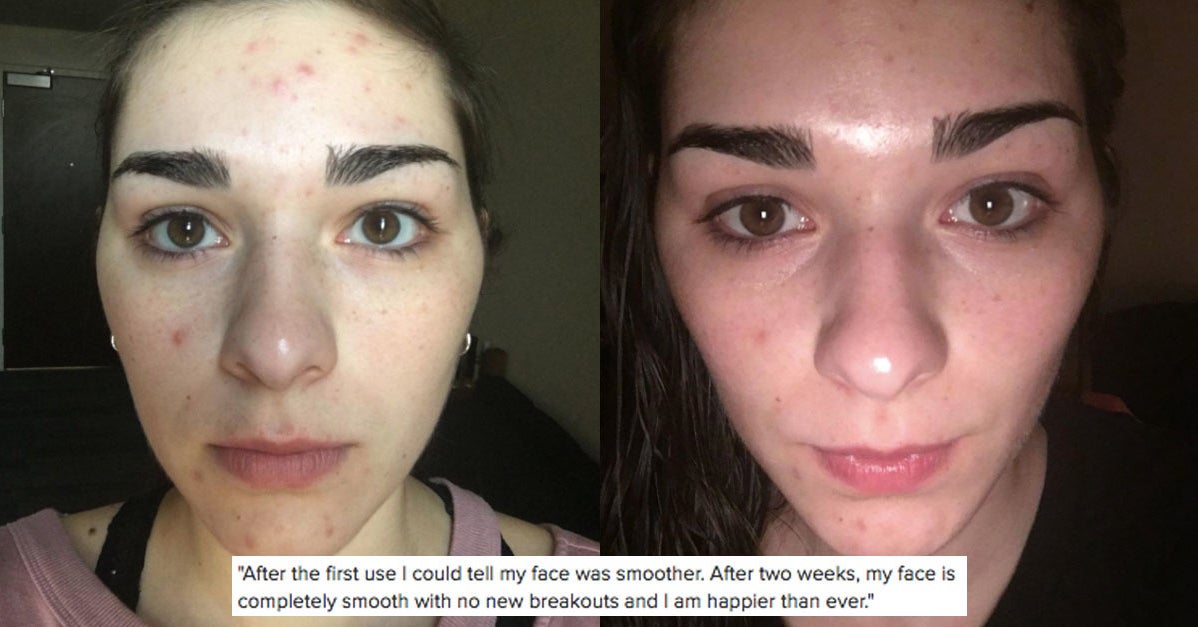 31 Amazing Skin Care Products With Over 1,000 Reviews