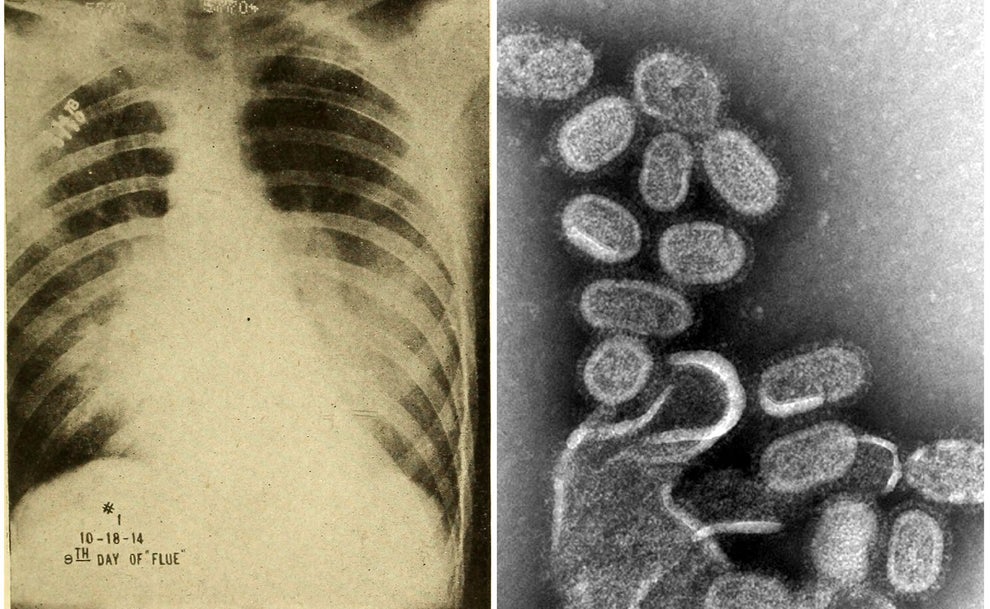 22 Pictures Show What The 1918 Flu Pandemic Really Looked Like