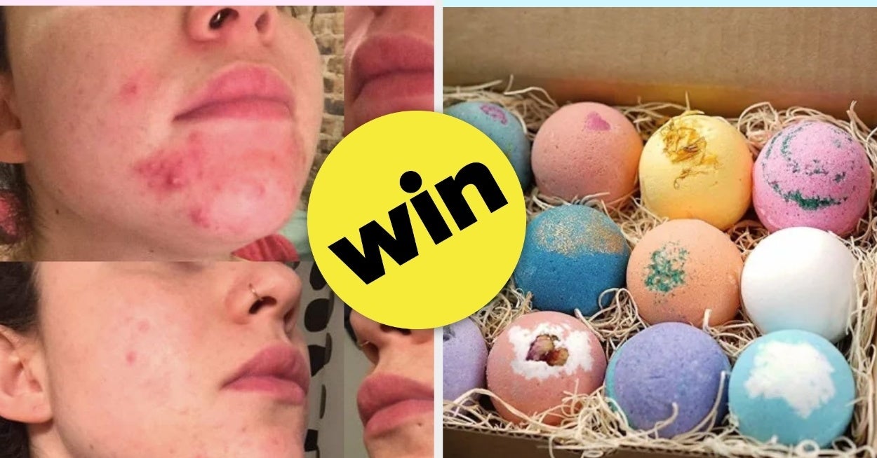 Just 30 Amazing Products For Anyone Who Has Skin