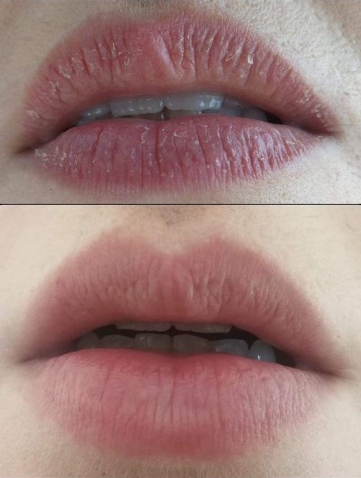 Chapped Lips Walking Meme | Lipstutorial.org