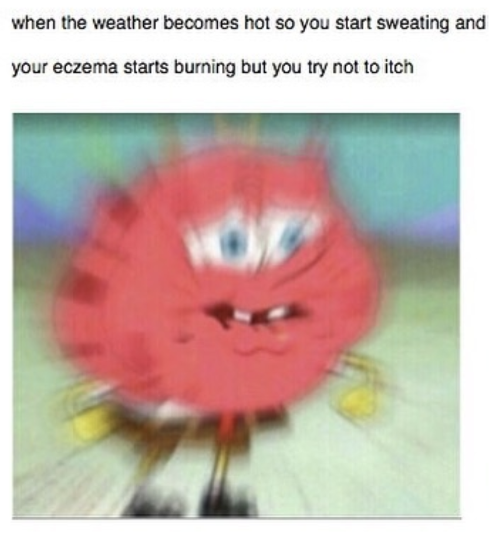 19 Memes About Eczema That Are Way Too Relatable