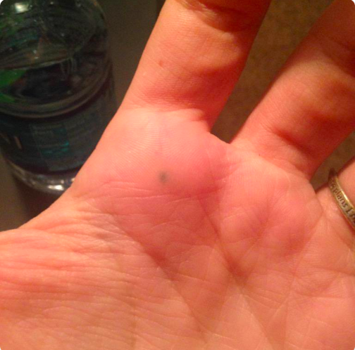 Stabbed By A Pencil And Still Have A Mark? Answer These Questions