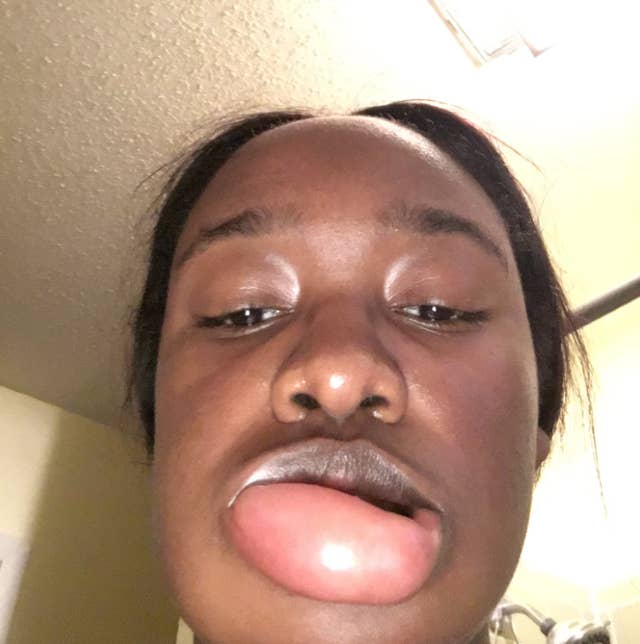 Big Lips Funny Jokes | Lipstutorial.org