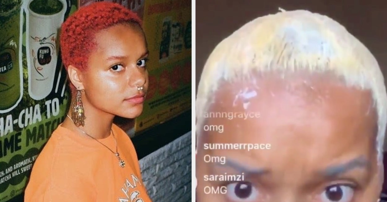 A Teen Accidentally Livestreamed Her Hair Falling Out On Instagram