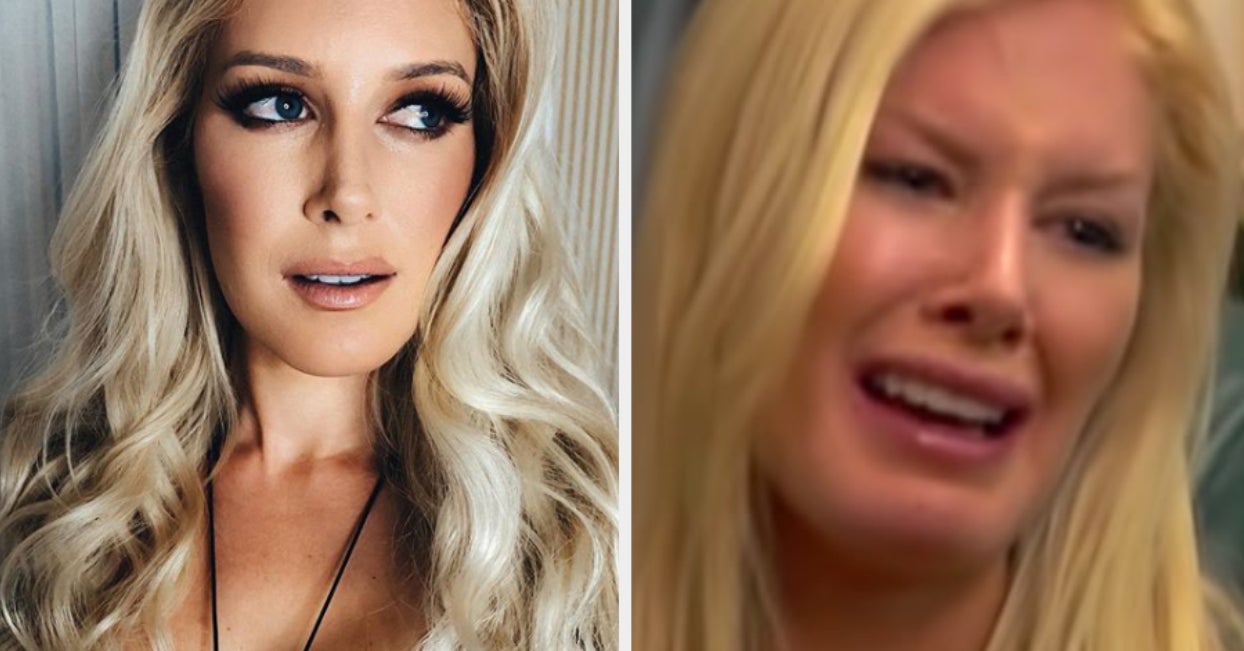 Heidi Montag And Spencer Pratt Revealed Why Had 10 Plastic Surgeries In One Day