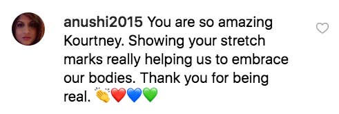 kourtney stretch marks