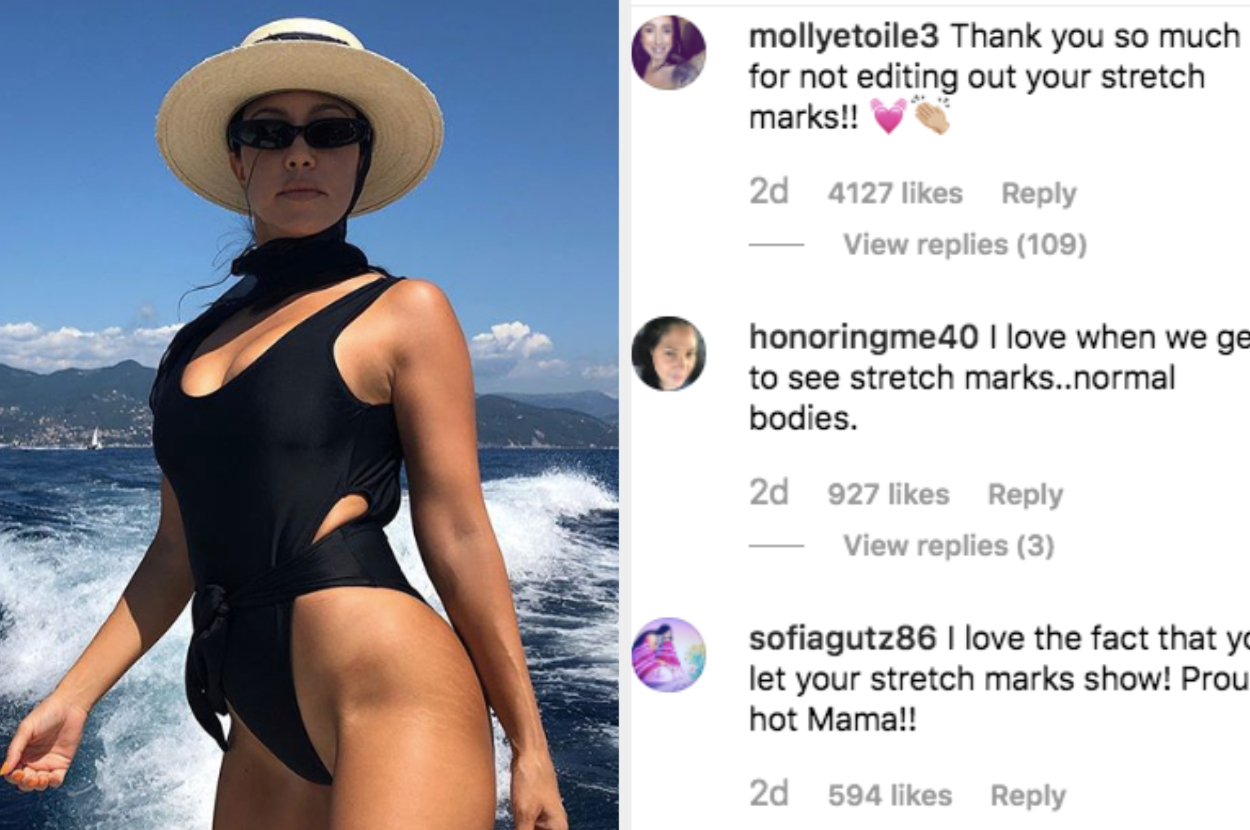 kourtney stretch marks