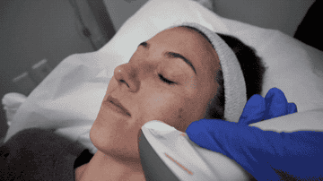 I Tried To Dramatically Change My Skin Using Cosmetic Lasers And Here's ...