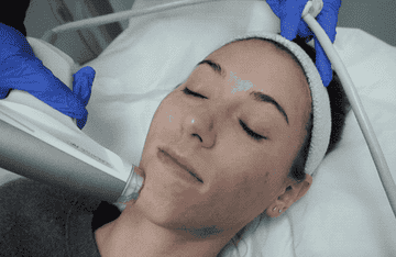 I Tried To Dramatically Change My Skin Using Cosmetic Lasers And Here's ...