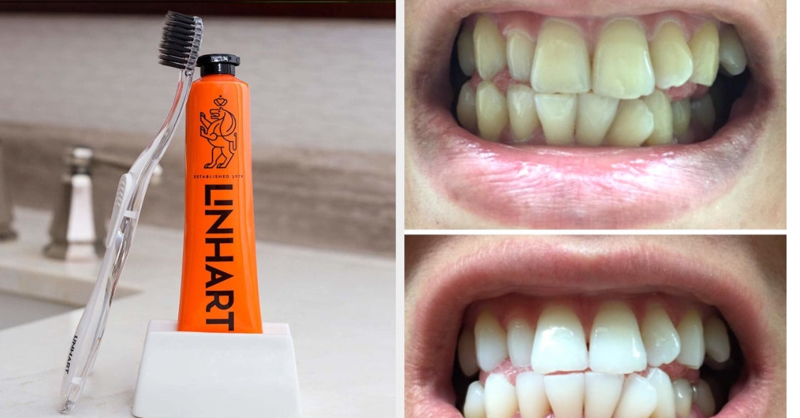 21 Of The Best Teeth Whiteners You Can Get On Amazon