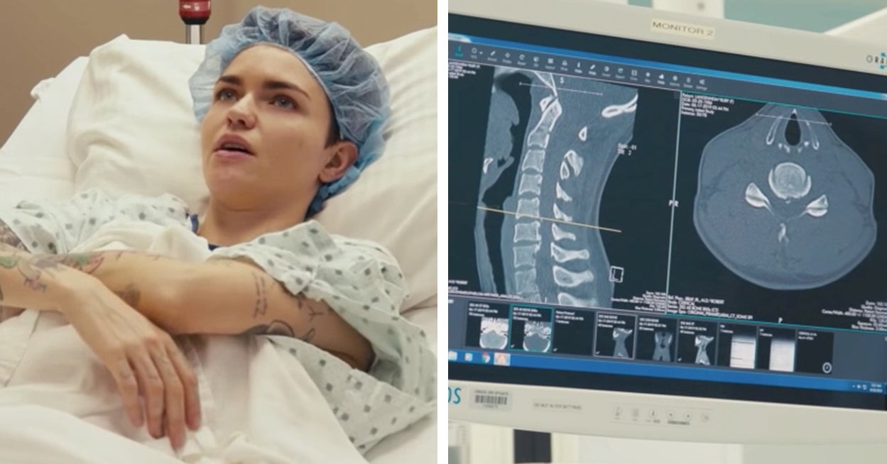 Ruby Rose Posts Graphic Video Of Neck Surgery Following "Batwoman" Stunts