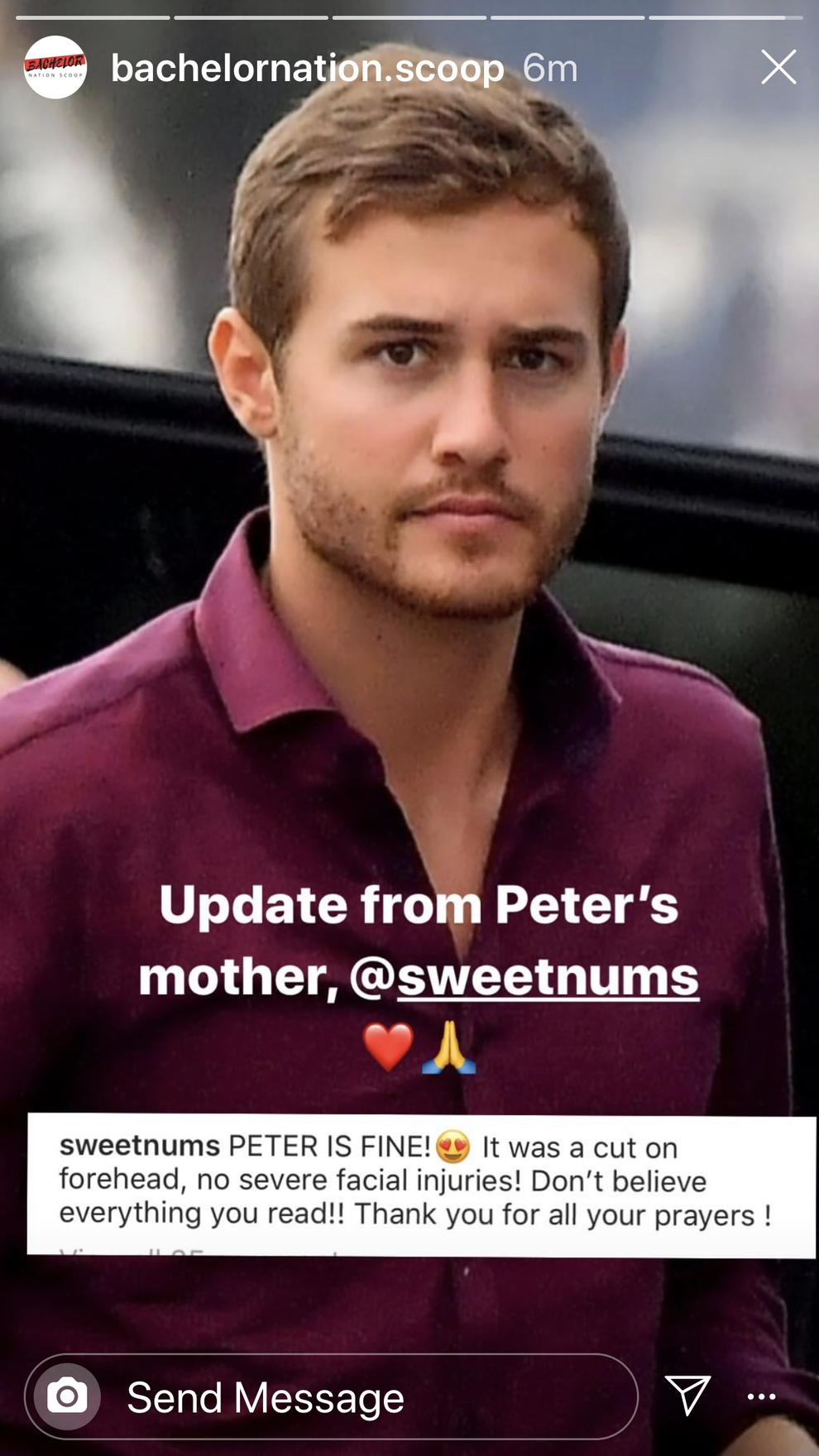 Here's Everything We Know About Peter From "The Bachelor's" Freak Accident