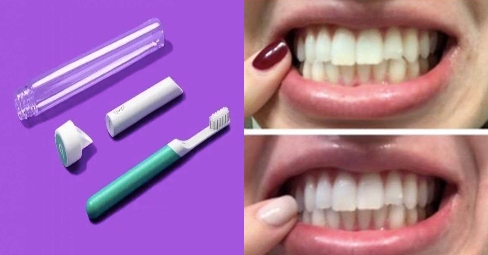 18 Things For Anyone With Teeth