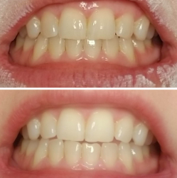 18 Things For Anyone With Teeth