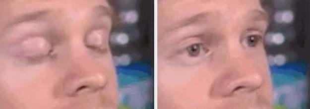 Funny Big Lips Jokes | Lipstutorial.org