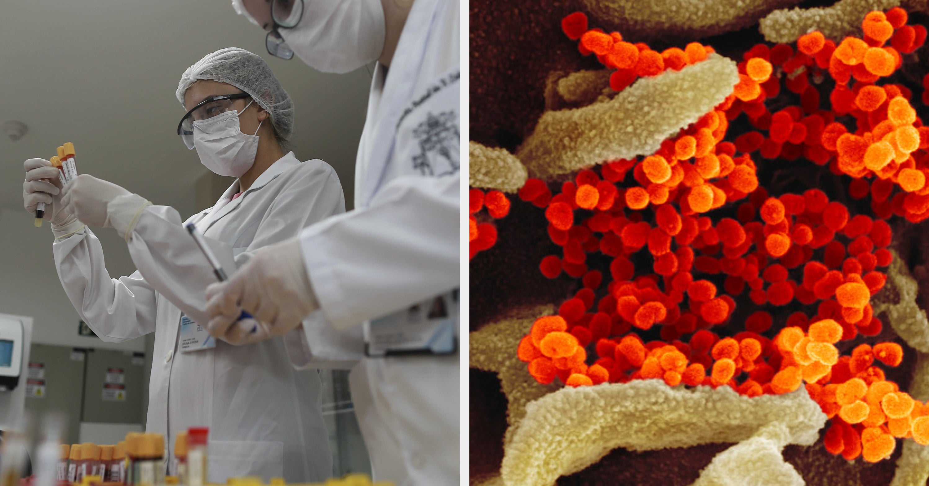 Eli Lilly and Johnson & Johnson Pause COVID Trials