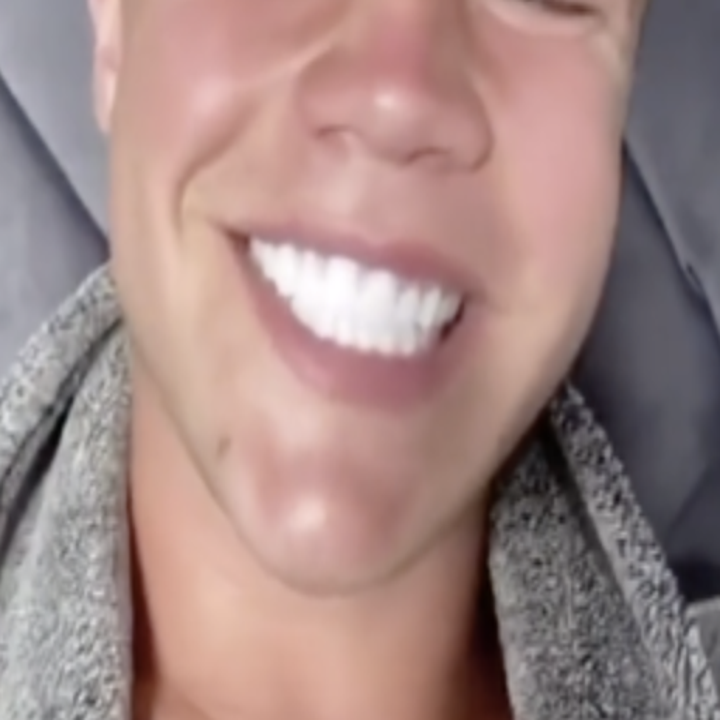 The TikTok "Veneers" Trend Is Dangerous