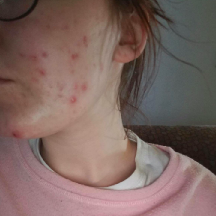 35 Products With Photos That Are Disgusting But Satisfying