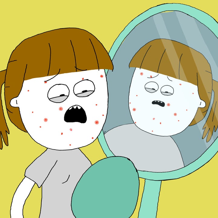 Pimple-Popping Simulation Game: Can You Help Weird Helga Look Her Best?