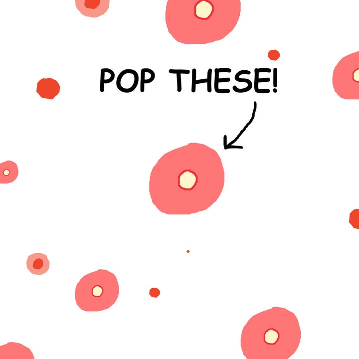 Pimple-Popping Simulation Game: Can You Help Weird Helga Look Her Best?