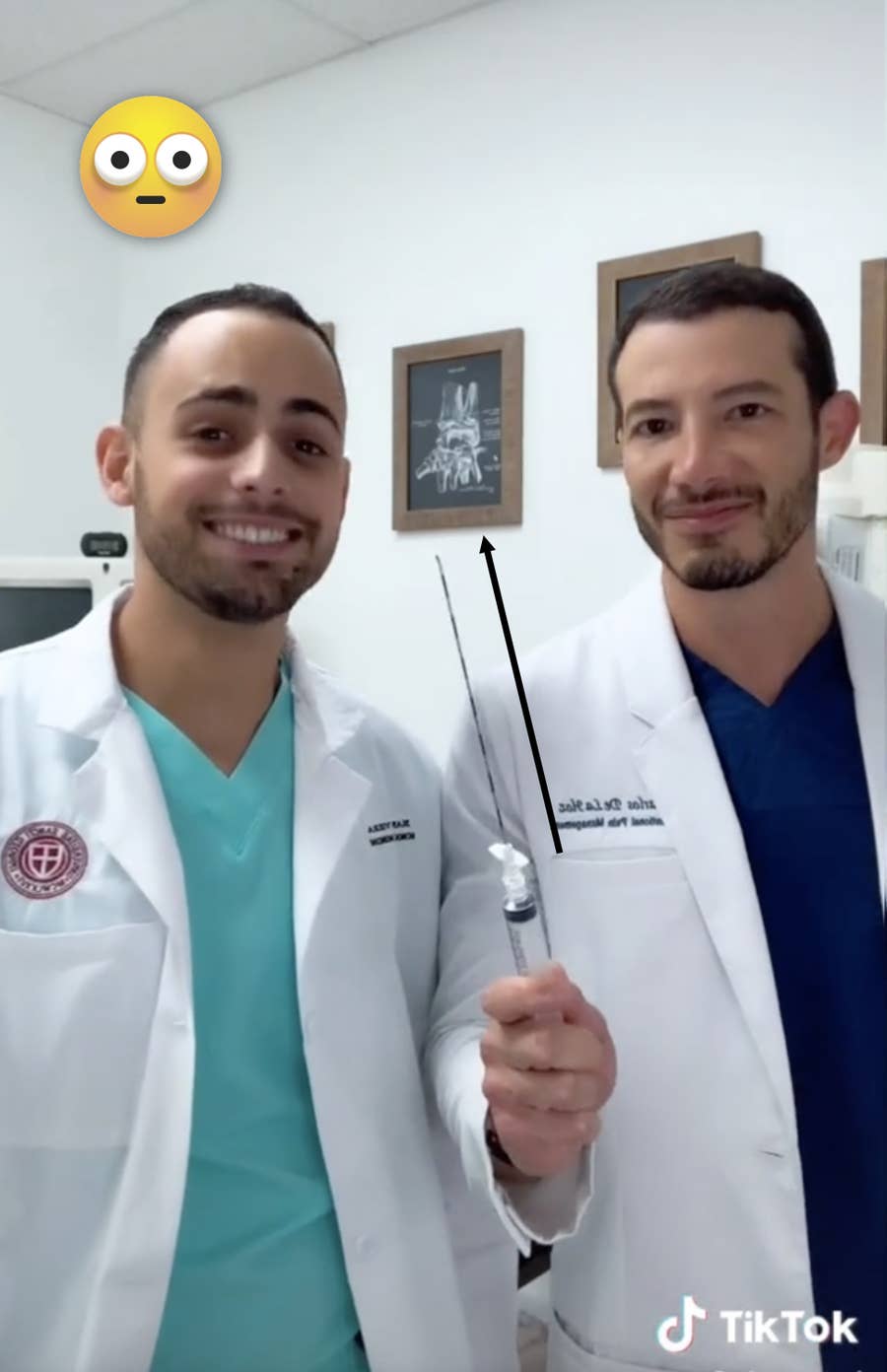 epidural needle comparison