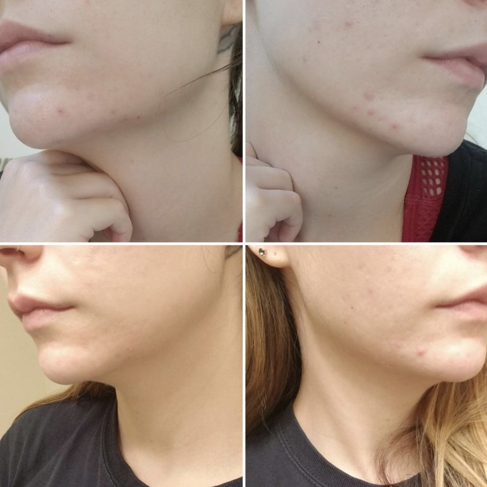 25 Amazon Beauty Products With Impressive Results