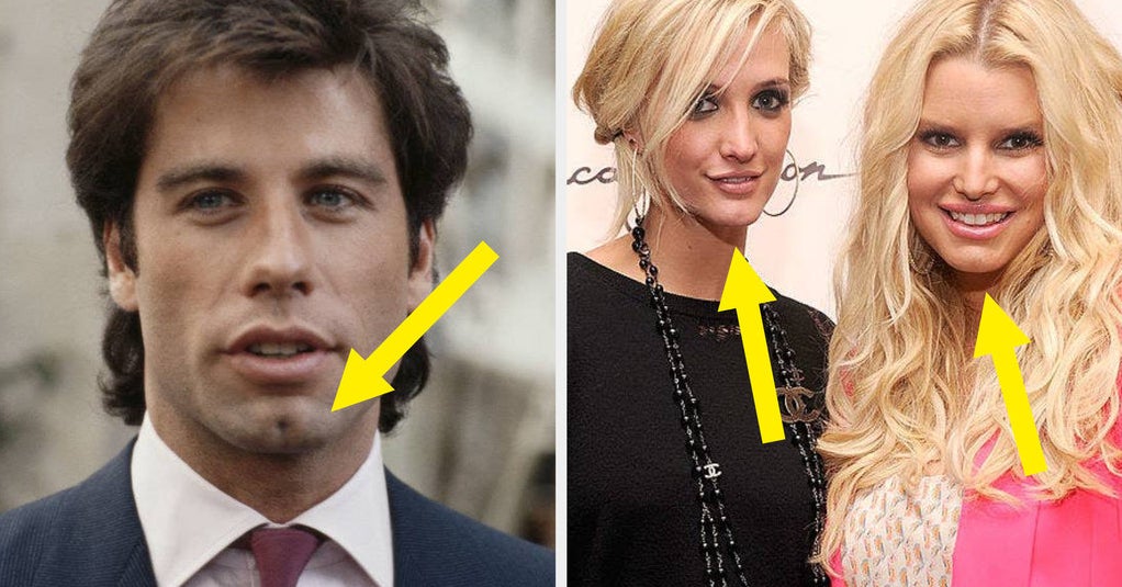 49 Famous People With Butt Chins