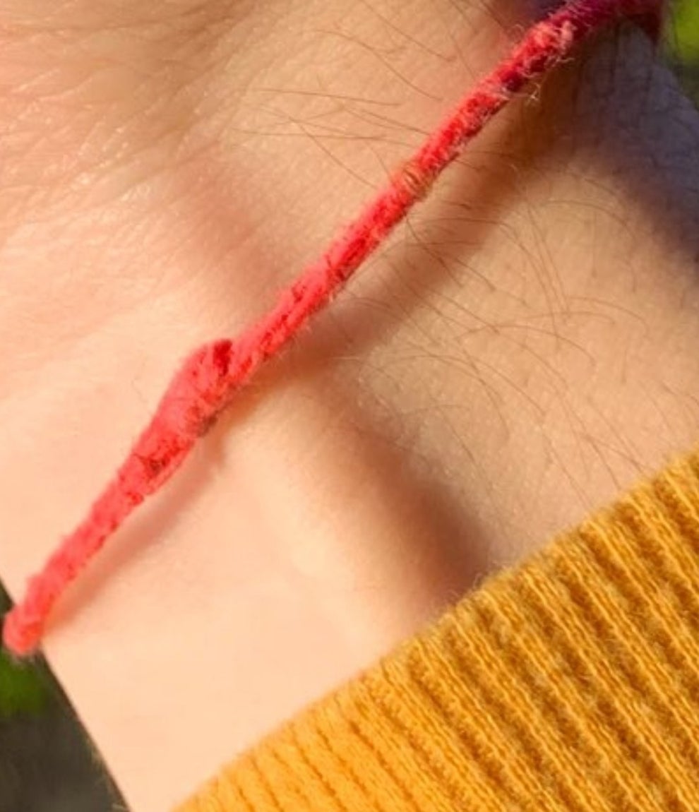 Palmaris Longus Muscle Missing In 14% Of People