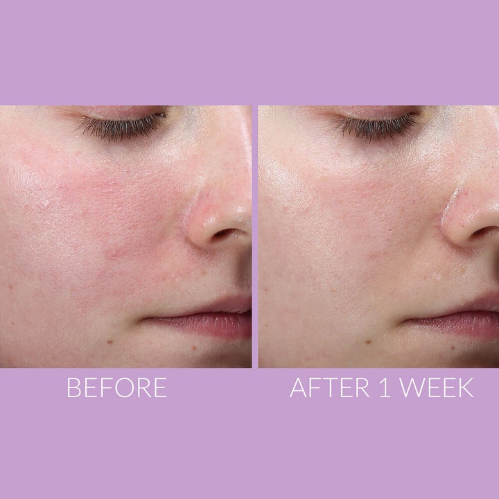 30 Skincare Products Reviewers With Sensitive Skin Love