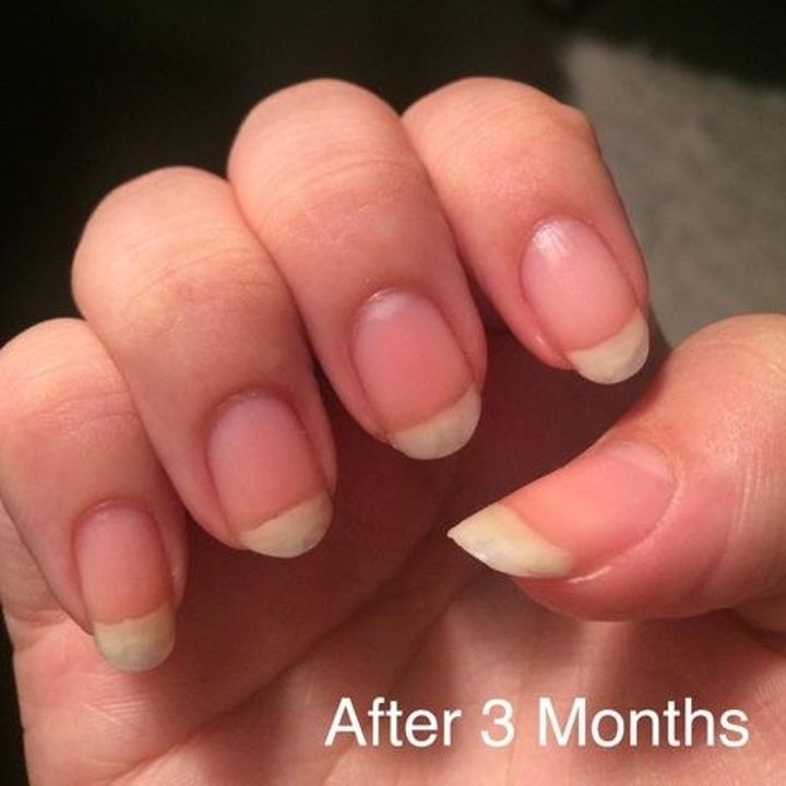 Just 20 Things That'll Give Your Hands A Makeover