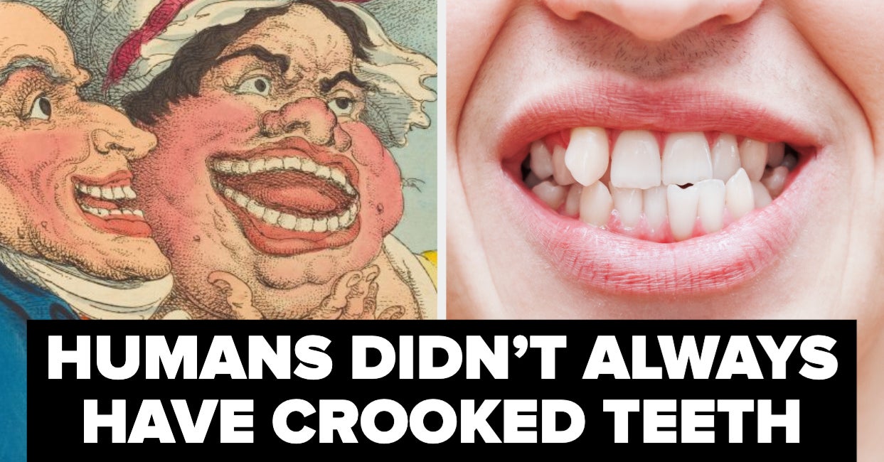 28 Facts About Teeth That Are Extremely Weird If You Ask Me