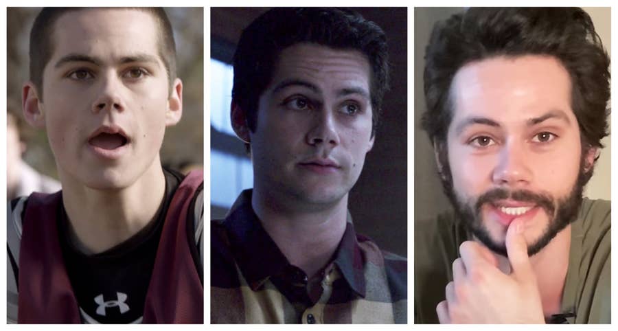 Teen Wolf Cast Then And Now 2020 Yosocial