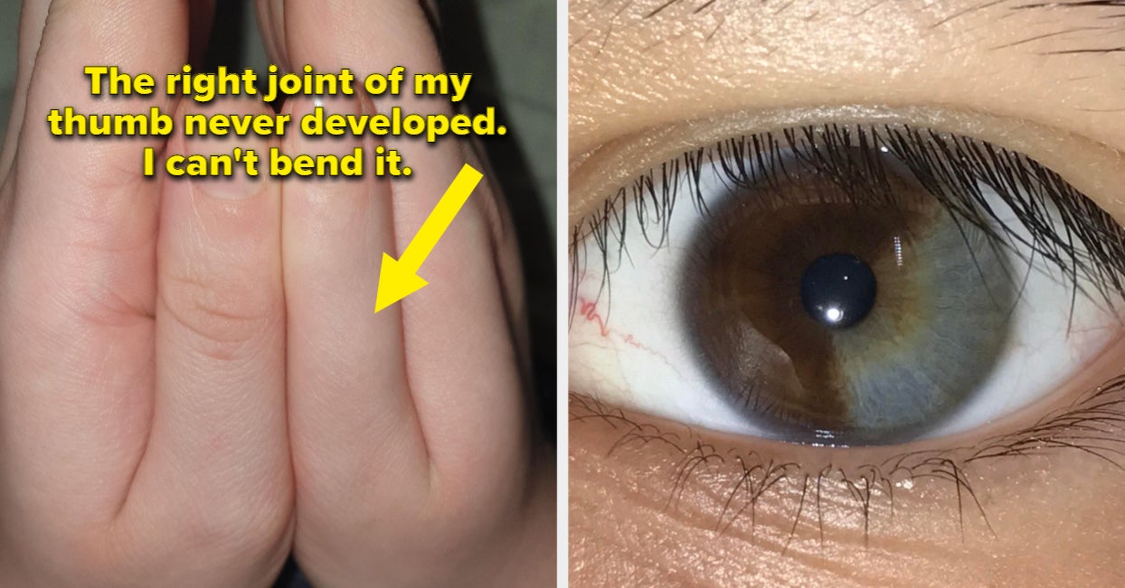 17 People Who Shared Weird Things About Their Bodies That Are Really ...