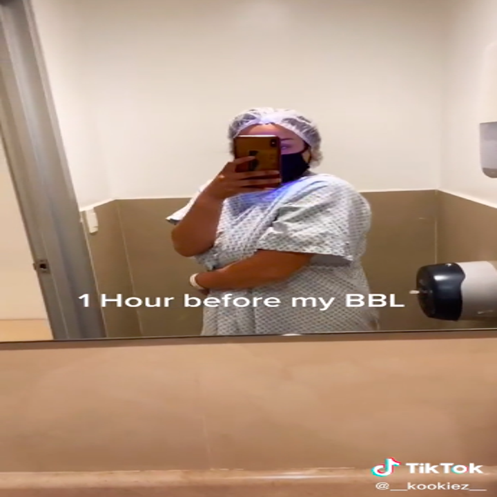 BBL Meaning: The Truth Behind This Popular Surgery