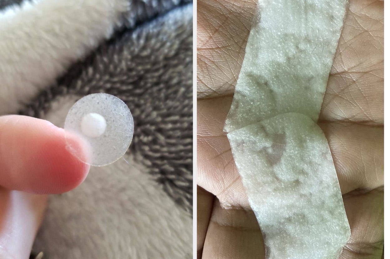 21 Best Pimple Patches To Clear Up Your Skin In 2022