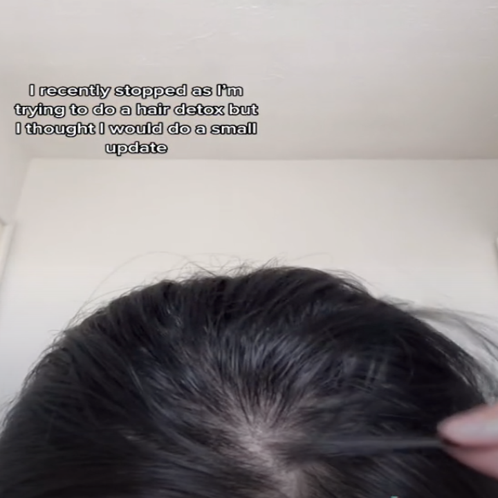 Rosemary Oil Helps Hair Growth