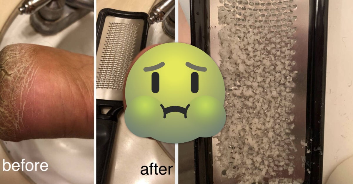 21 Before-And-After Photos That'll Make You Squeamish