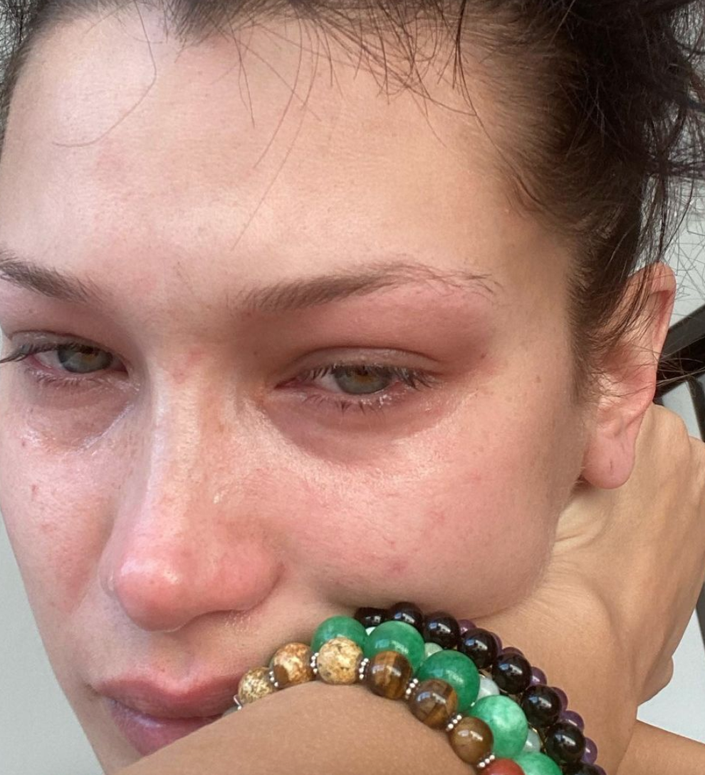 Bella Hadid Posts Crying Selfies About Anxiety