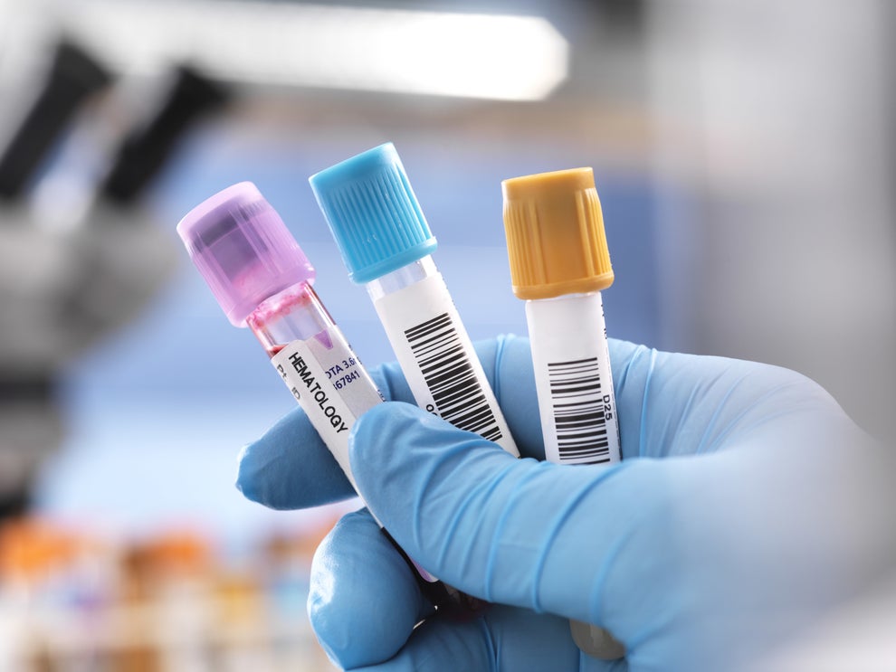 Accutane Before And After: How I Cleared Up My Lifelong Acne