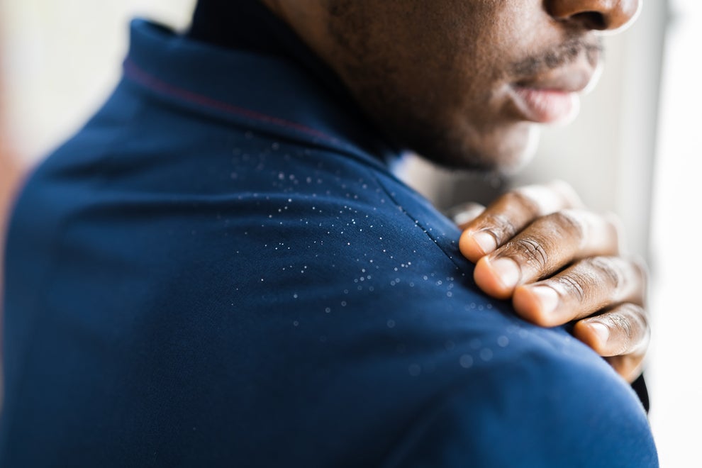 Tips To Treat A Dry Scalp And Dandruff In The Winter