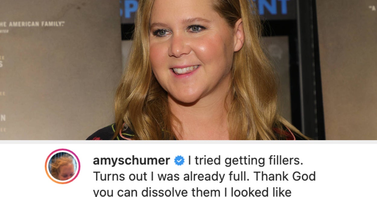 Amy Schumer Explains Why She Removed Her Facial Fillers