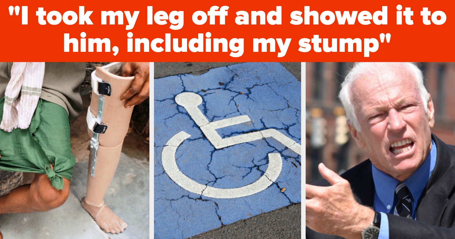 Woman Takes Off Prosthetic Leg After Man Yells At Her For Parking In ...