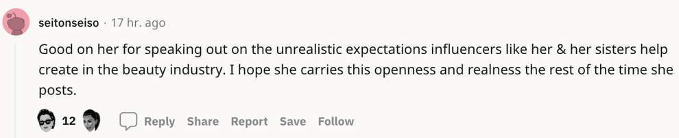 Kylie Jenner Got Real About Struggling “Mentally” And “Physically ...
