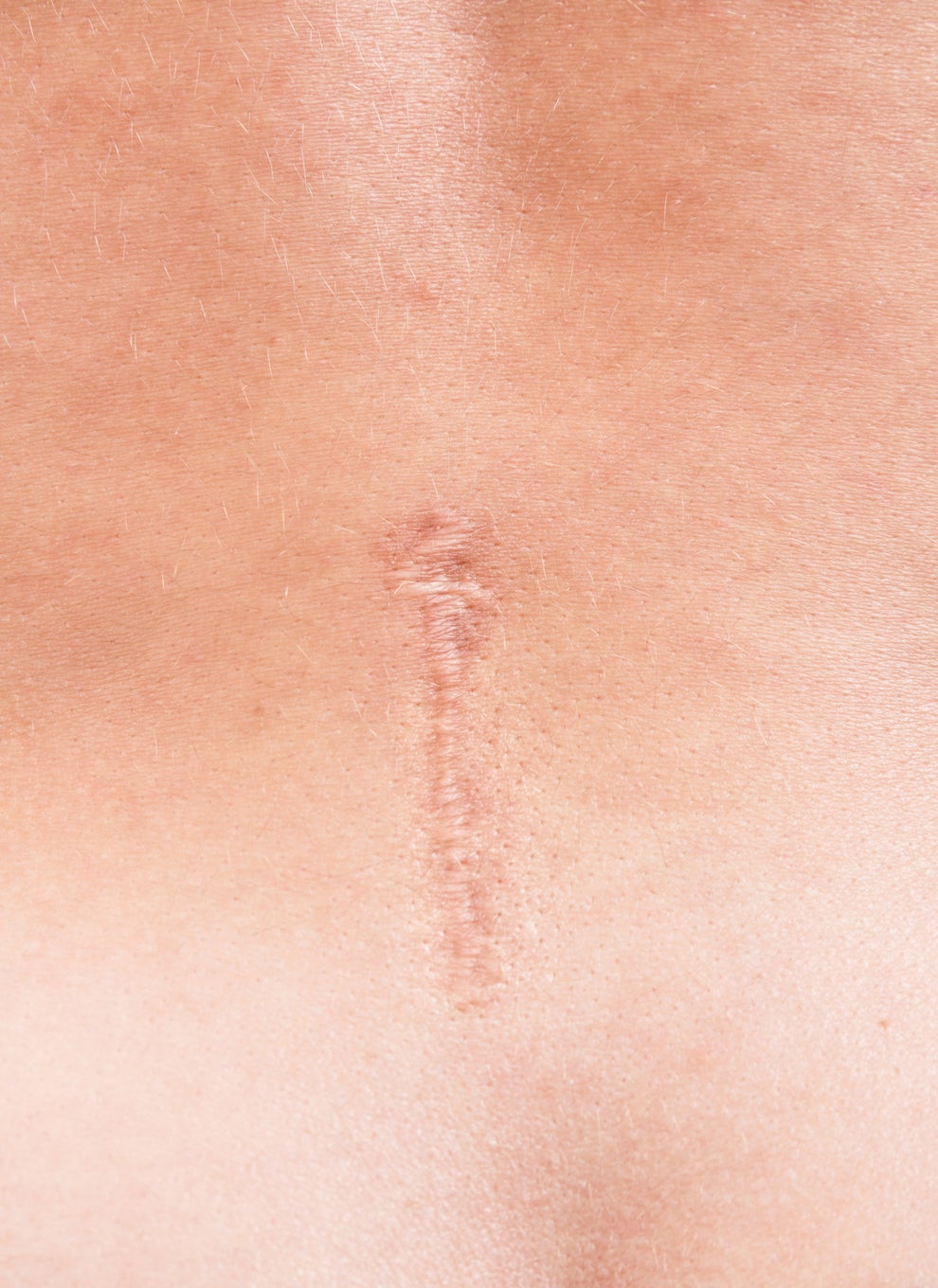 We Asked People To Share The Stories Behind Their Scars And Tell Us ...