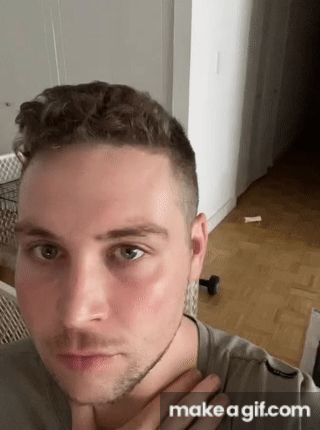 I Got Preventive Botox And This Is What Happened
