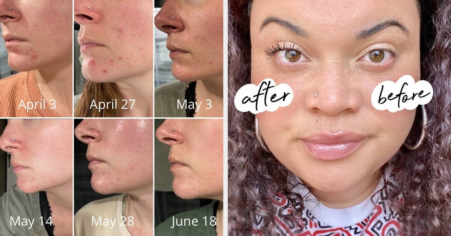 34 Beauty Products With Good Before And After Photos