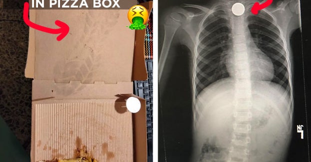 Photos Of People's Most Unfortunate, Bad Luck Moments