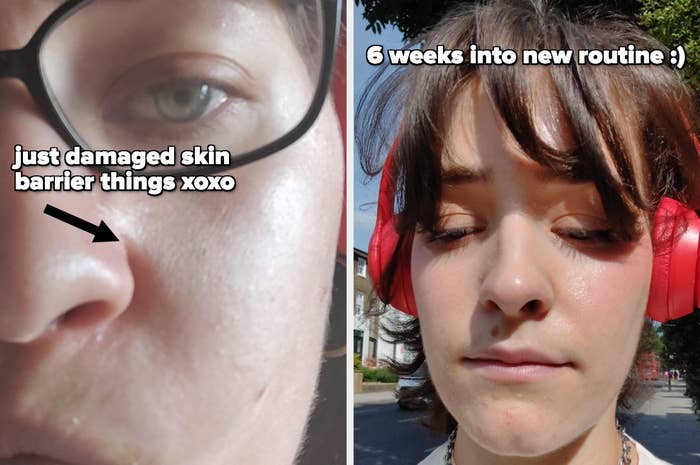 The Best OTC Skincare (According To My Dermatologist)