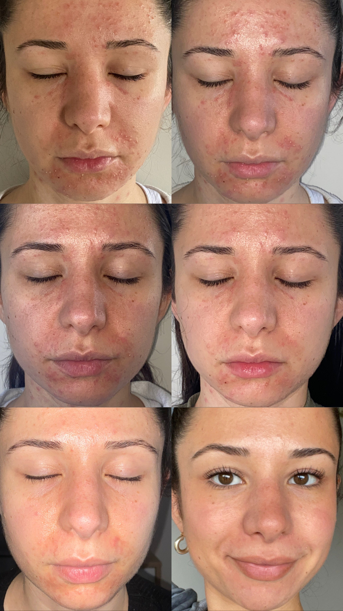 This Melbourne Beauty Brand Has Just Launched A First-Of-Its-Kind Skin ...