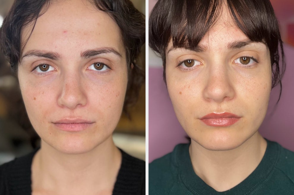 I Got My Lips Tattooed, And Here's How It Went